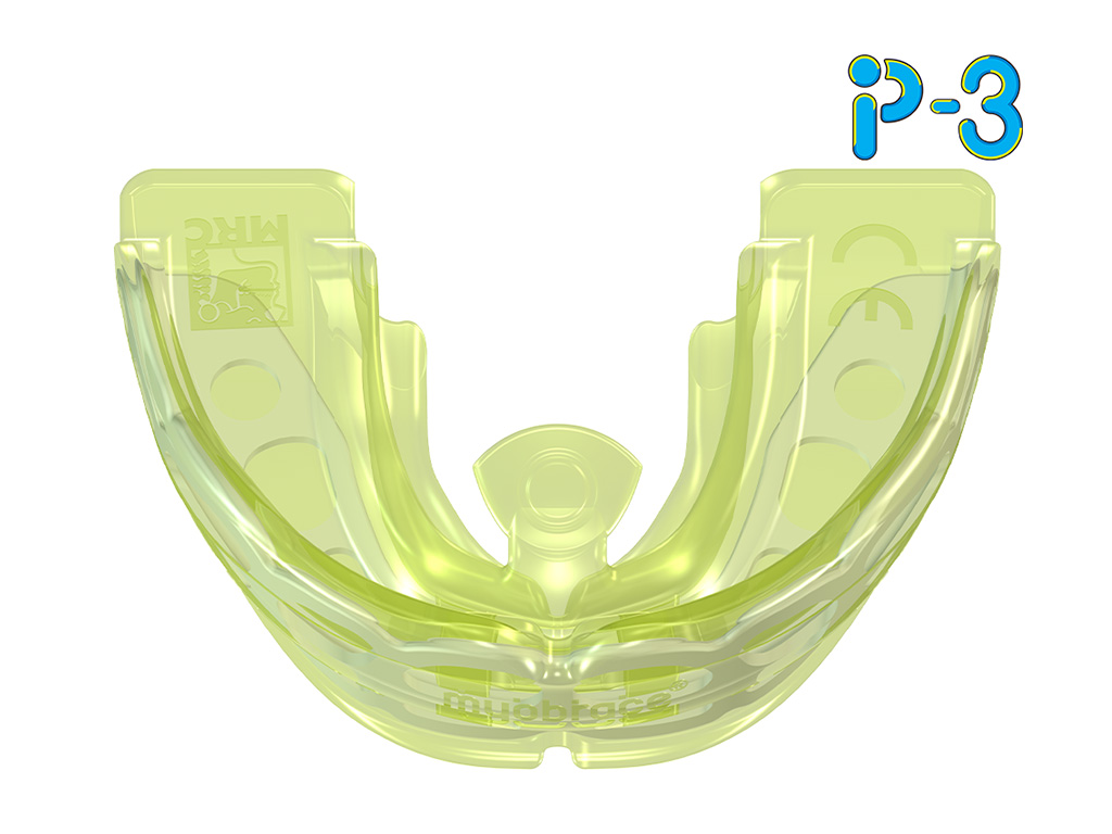 For Interceptive Class III